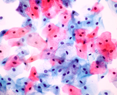 Range of basic and advanced cancer tests conducted at economic prices