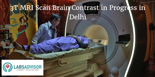 3T MRI Scan Brain Contrast Cost in Delhi - Get Up to 25% Discount in ...
