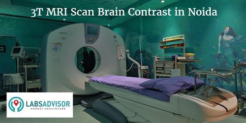 3T MRI Scan Brain Contrast Cost in Noida - Get Up to 25% Discount in Best Lab(s) | LabsAdvisor