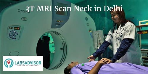3T MRI Scan Neck Cost in Delhi - Get Up to 50% Discount in Best Lab(s ...