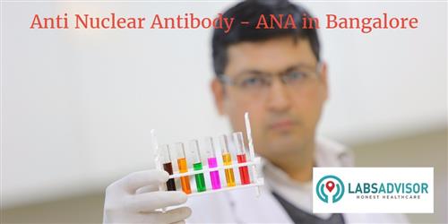 ANA Test / Anti Nuclear Antibody Test Cost in Bangalore / Bengaluru ...
