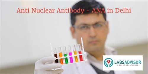 ANA Test / Anti Nuclear Antibody Test Cost in Delhi - Get Up to 54% ...