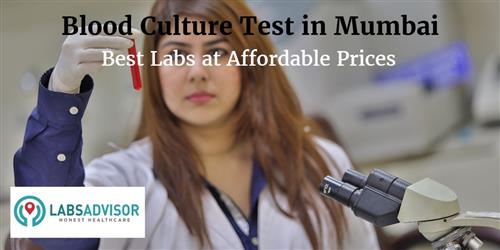 Blood Culture Test Cost in Mumbai - Get Up to 20% Discount in Best Lab ...