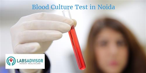 Blood Culture Test Cost in Noida - Get Up to 25% Discount in Best Lab(s ...