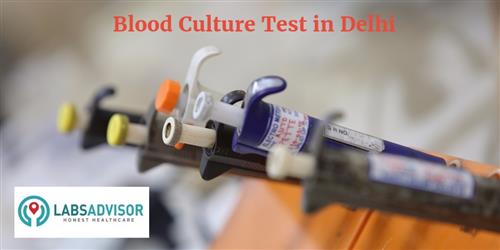 Blood Culture Test Cost in Delhi - Get Up to 25% Discount in Best Lab(s ...
