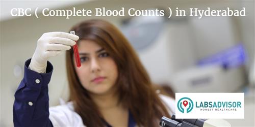 Complete Blood Count Test (CBC) Cost in Hyderabad - Get Up to 50% ...