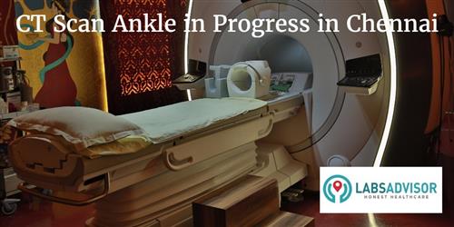 CT Scan Ankle Cost in Chennai - Get Up to 0% Discount in Best Lab(s ...
