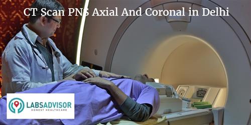 CT Scan PNS Axial And Coronal Cost in Delhi - Get Up to 30% Discount in ...