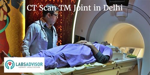 CT Scan TM Joint Cost in Delhi - Get Up to 25% Discount in Best Lab(s ...