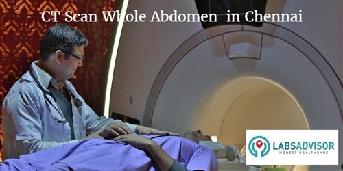 CT Scan Whole Abdomen Cost in Chennai - Get Up to 0% Discount in Best ...