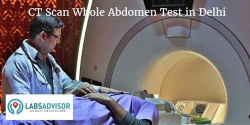 CT Scan Whole Abdomen Cost in Delhi - Get Up to 30% Discount in Best ...