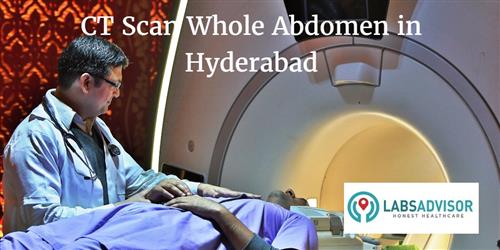 CT Scan Whole Abdomen Cost in Hyderabad - Get Up to 10% Discount in ...