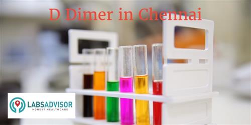 D Dimer Test Cost in Chennai - Get Up to 25% Discount in Best Lab(s ...