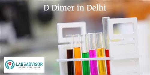 D Dimer Test Cost in Delhi - Get Up to 40% Discount in Best Lab(s ...