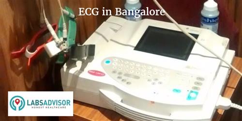 ECG Cost in Bangalore / Bengaluru - Get Up to 30% Discount in Best Lab ...