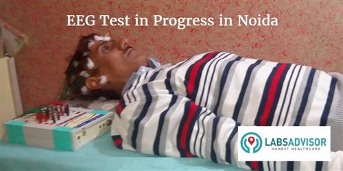EEG Cost in Noida - Get Up to 54% Discount in Best Lab(s) | LabsAdvisor