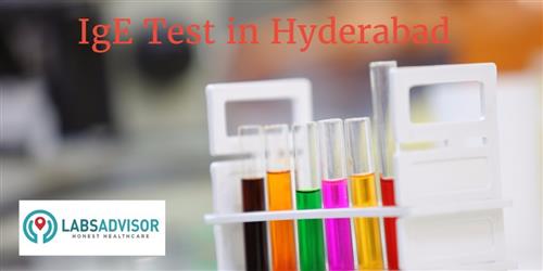IgE Test Cost in Hyderabad - Get Up to 50% Discount in Best Lab(s ...