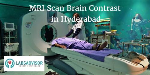 MRI Scan Brain Contrast Cost in Hyderabad - Get Up to 34% Discount in ...