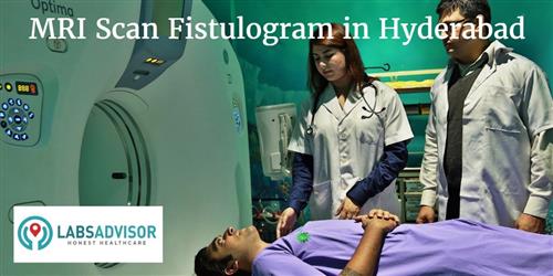 MRI Scan Fistulogram Cost in Hyderabad - Get Up to 35% Discount in Best ...