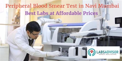 Peripheral Blood Smear Cost in Navi Mumbai - Get Up to 25% Discount in ...