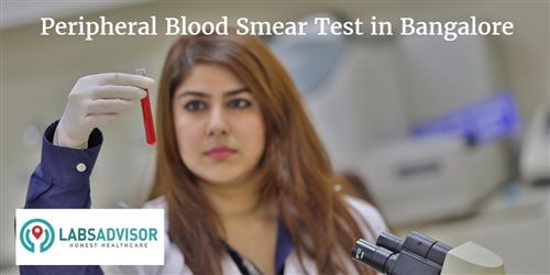 Peripheral Blood Smear Cost in Bangalore / Bengaluru - Get Up to 15% ...