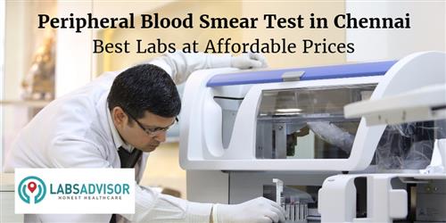 Peripheral Blood Smear Cost in Chennai - Get Up to 25% Discount in Best ...