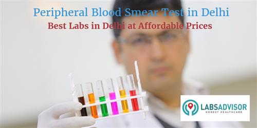 Peripheral Blood Smear Cost in Delhi - Get Up to 40% Discount in Best ...