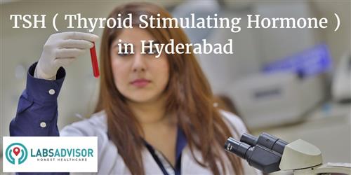 Thyroid Stimulating Hormone Test Cost in Hyderabad - Get Up to 50% ...