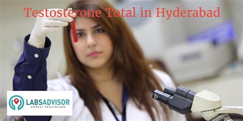 Serum Testosterone-Total Cost in Hyderabad - Get Up to 50% Discount in ...