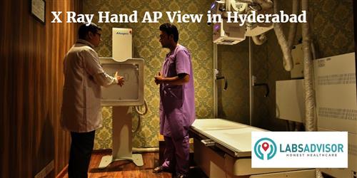 X Ray Hand AP View Cost in Hyderabad - Get Up to 20% Discount in Best ...