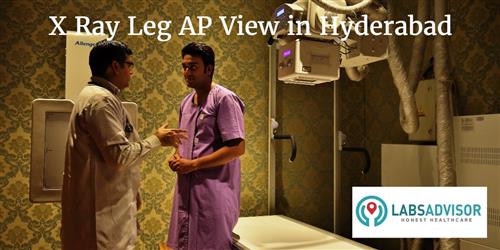 X Ray Leg AP View Cost in Hyderabad - Get Up to 20% Discount in Best ...