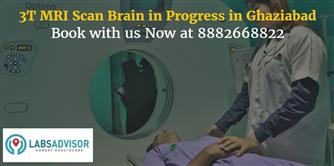 3t Mri Scan Brain Test Price List in India | Cost ₹3500 Onwards ...