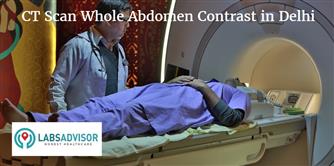 Ct Scan Whole Abdomen Contrast Test Price List in India | Cost ₹2309 ...