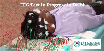 Eeg Test Price List in India | Cost ₹225 Onwards | LabsAdvisor.com