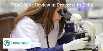 Fnac Slide Review Test Price List in India | Cost ₹488 Onwards ...