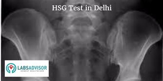 X-ray Hsg Test Test Price List in India | Cost ₹1320 Onwards ...